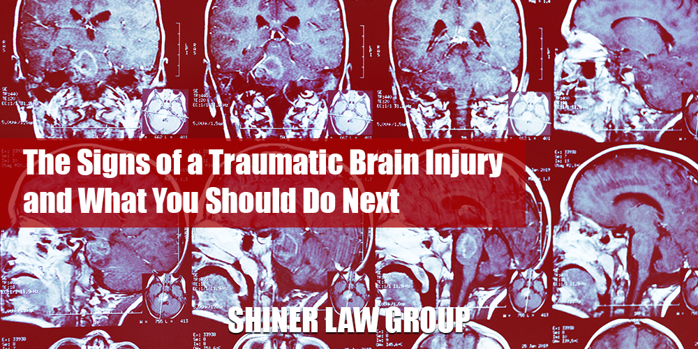 Signs of Traumatic Brain Injury & What To Do Next | Shiner Law Group